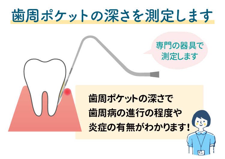 歯周ポケットの掃除：健康な歯を保つ必要性と方法 | 野田阪神アルプス歯科【公式】野田阪神・海老江・福島区の歯医者さん